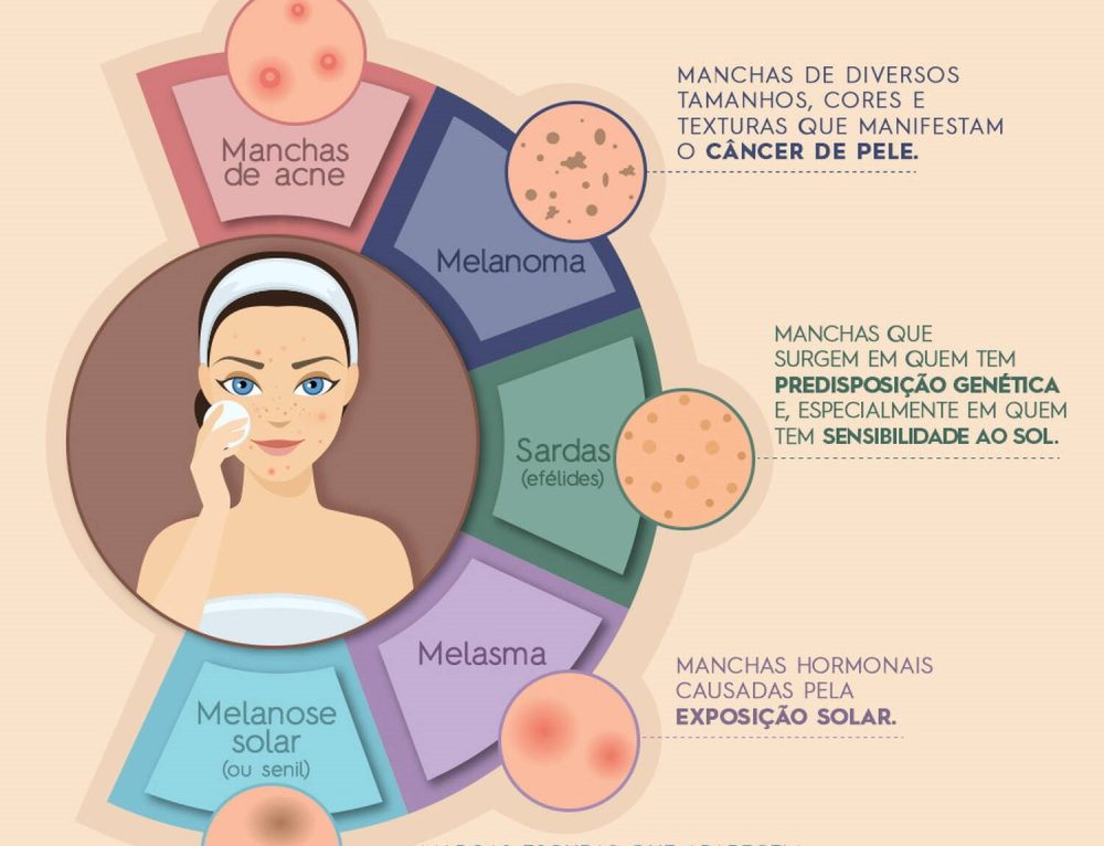 Patologias da Mama: tipos, sintomas e quem está em risco – Augusta ...